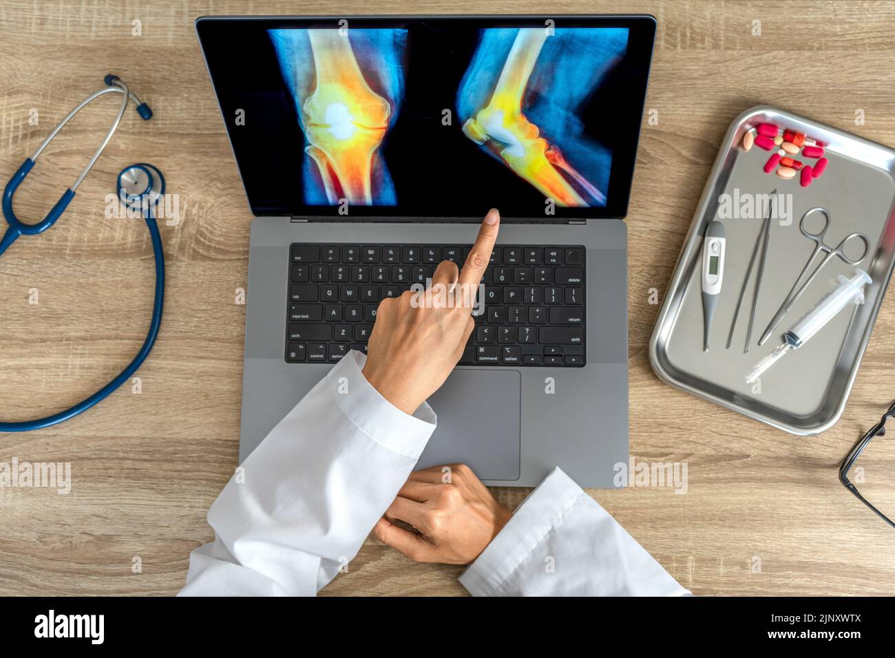 Top view of doctor showing a x-ray of pain in the knee Stock Photo - Alamy