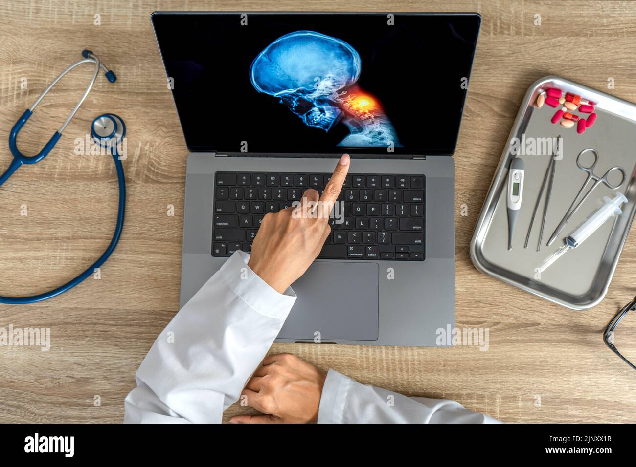 Top view of Doctor showing a x-ray of pain in the neck. Migraine ...