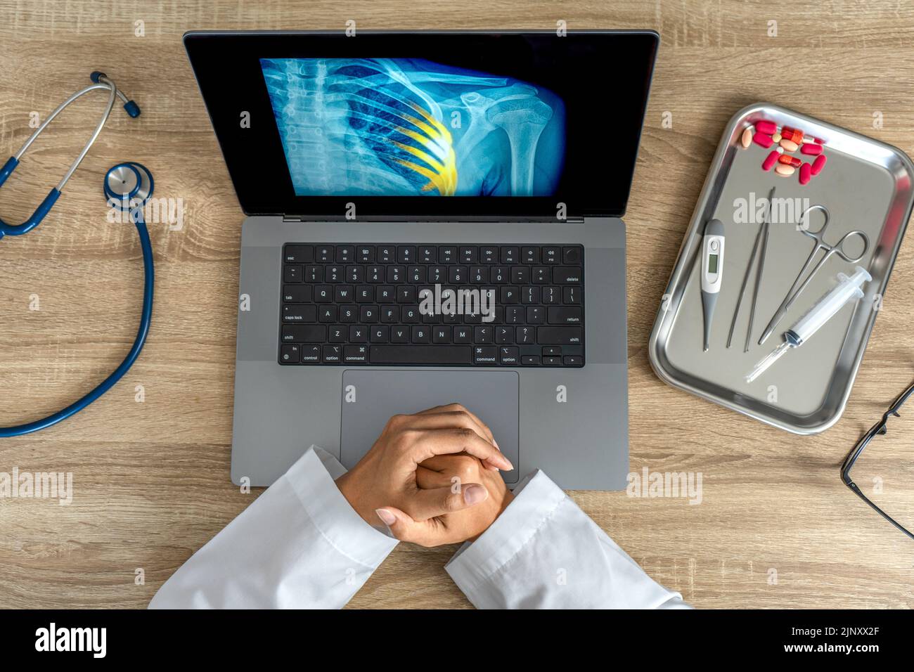 Top view Doctor looking a x-ray of pain in the ribs. Heart attack or ...