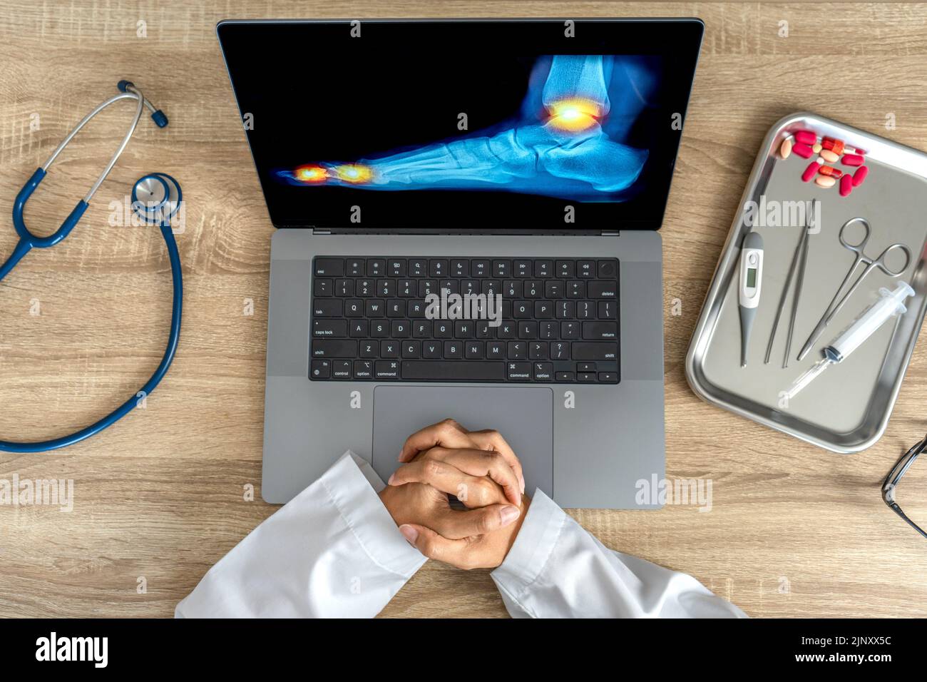 Top view of doctor looking a x-ray of foot. Pain ankle and toes injury ...