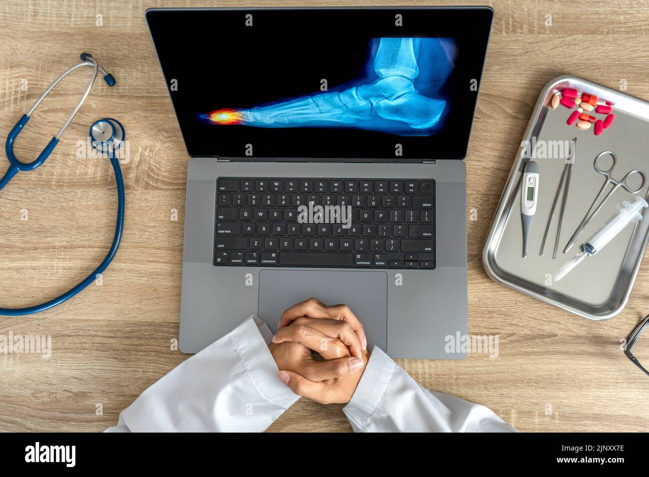 Top view of doctor showing a x-ray of foot. Pain toes injury Stock ...