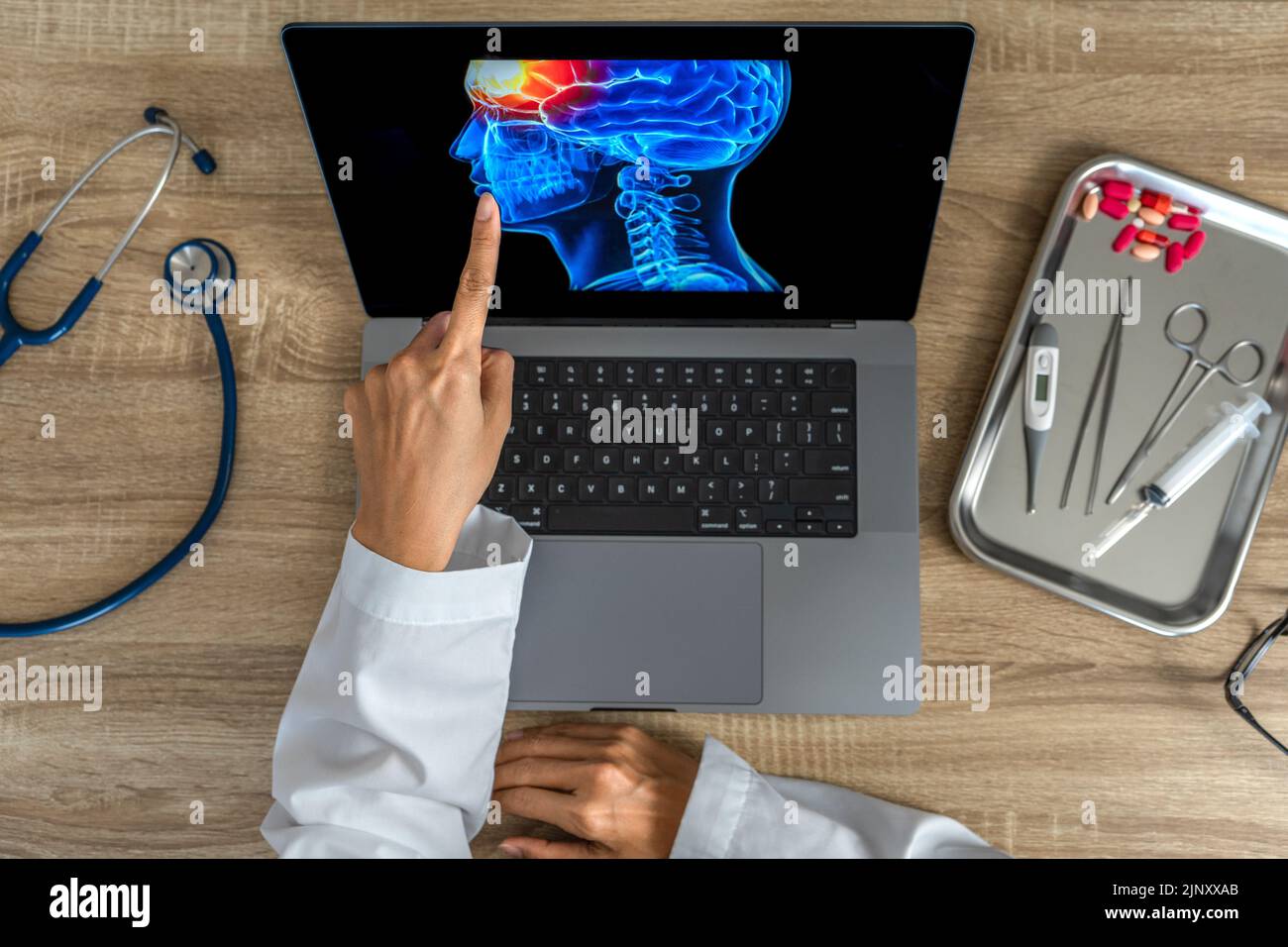 Top view of doctor showing a x-ray of pain in the brain on a laptop ...