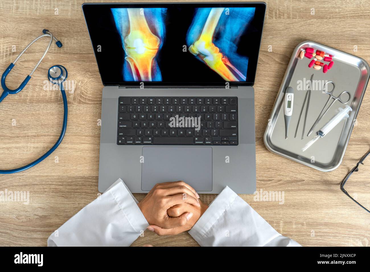 Top view of doctor looking a x-ray of pain in the knee Stock Photo - Alamy