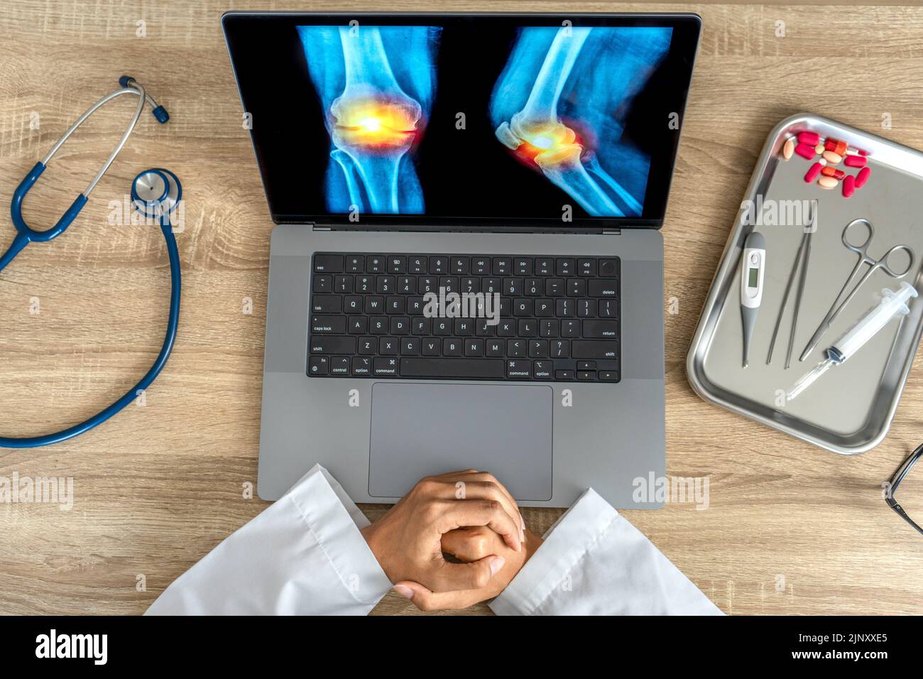 Top view of doctor looking a x-ray of pain in the knee Stock Photo - Alamy