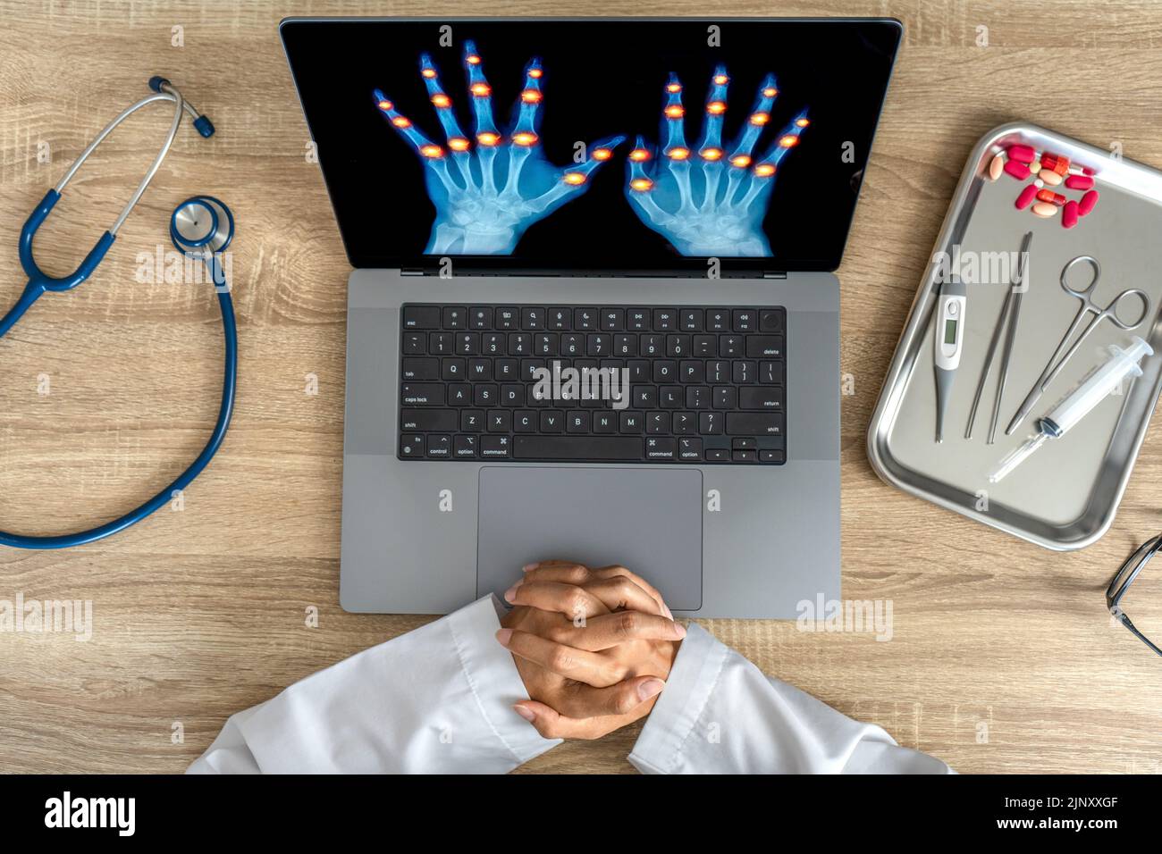 Top view of doctor looking x-ray of hands Stock Photo - Alamy