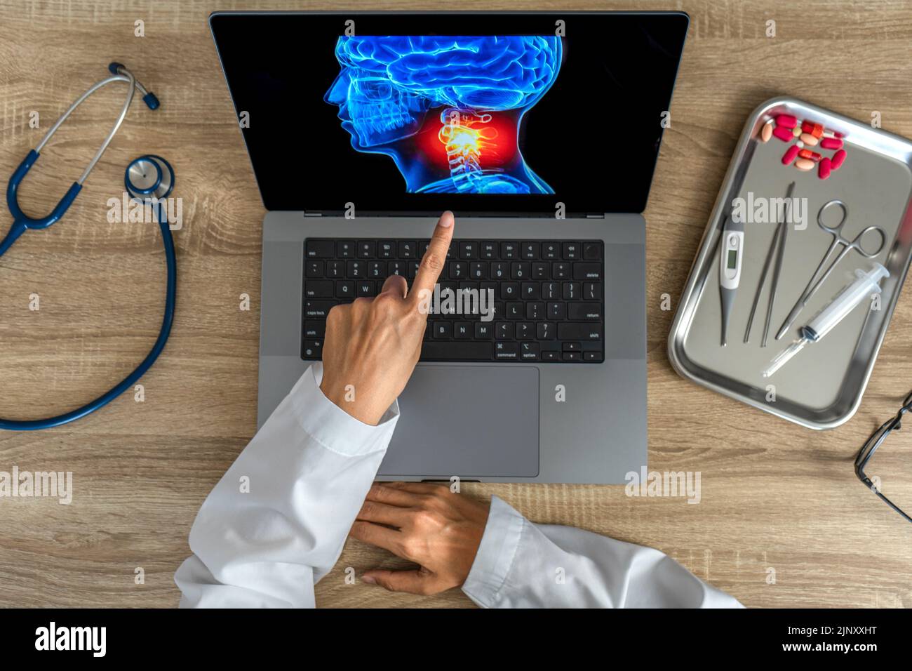 Top view of Doctor showing a x-ray of pain in the neck. Migraine ...