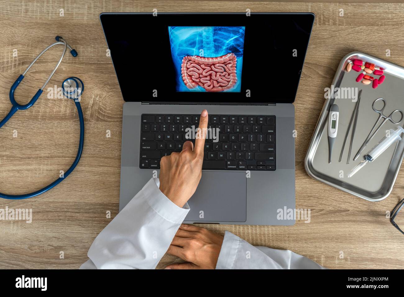 Top view of doctor showing a x-ray of stomach and intestine Stock Photo ...