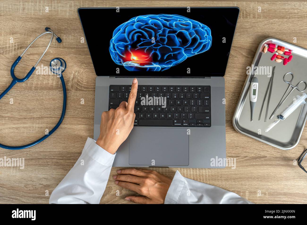 Top view of doctor showing a x-ray of pain in the brain on a laptop ...