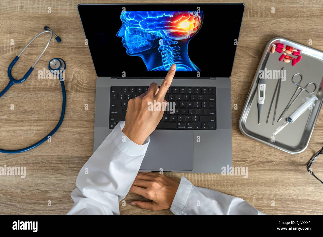 Top view of doctor showing a x-ray of pain in the brain on a laptop ...