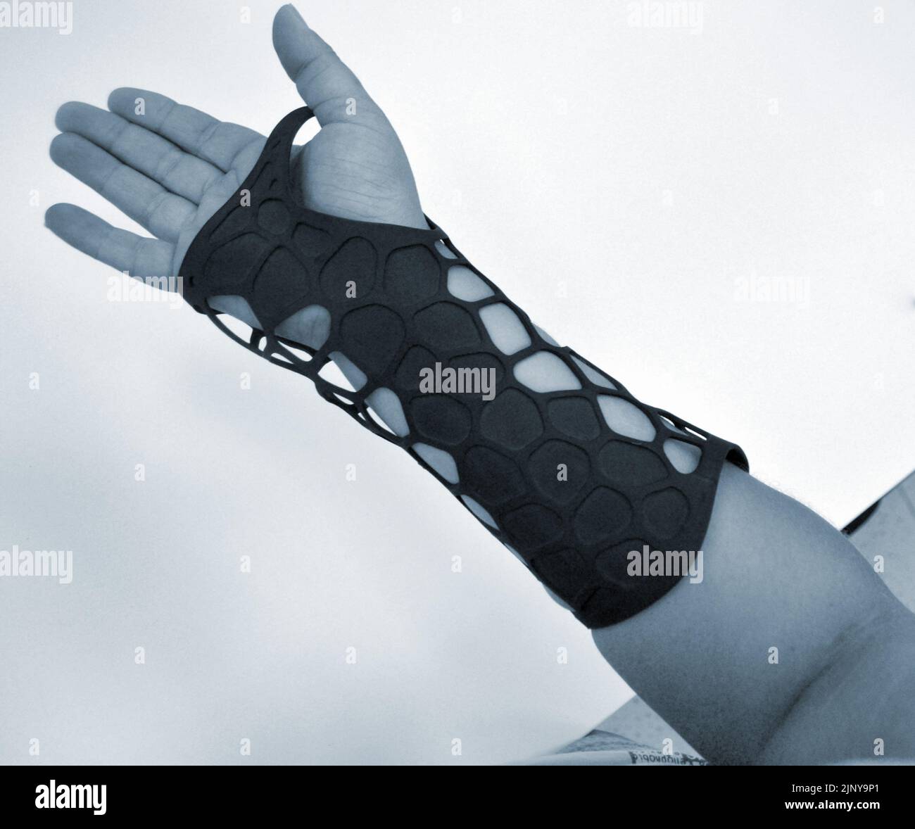 Orthopedic plastic prosthesis printed on powder 3D printer on hand ...