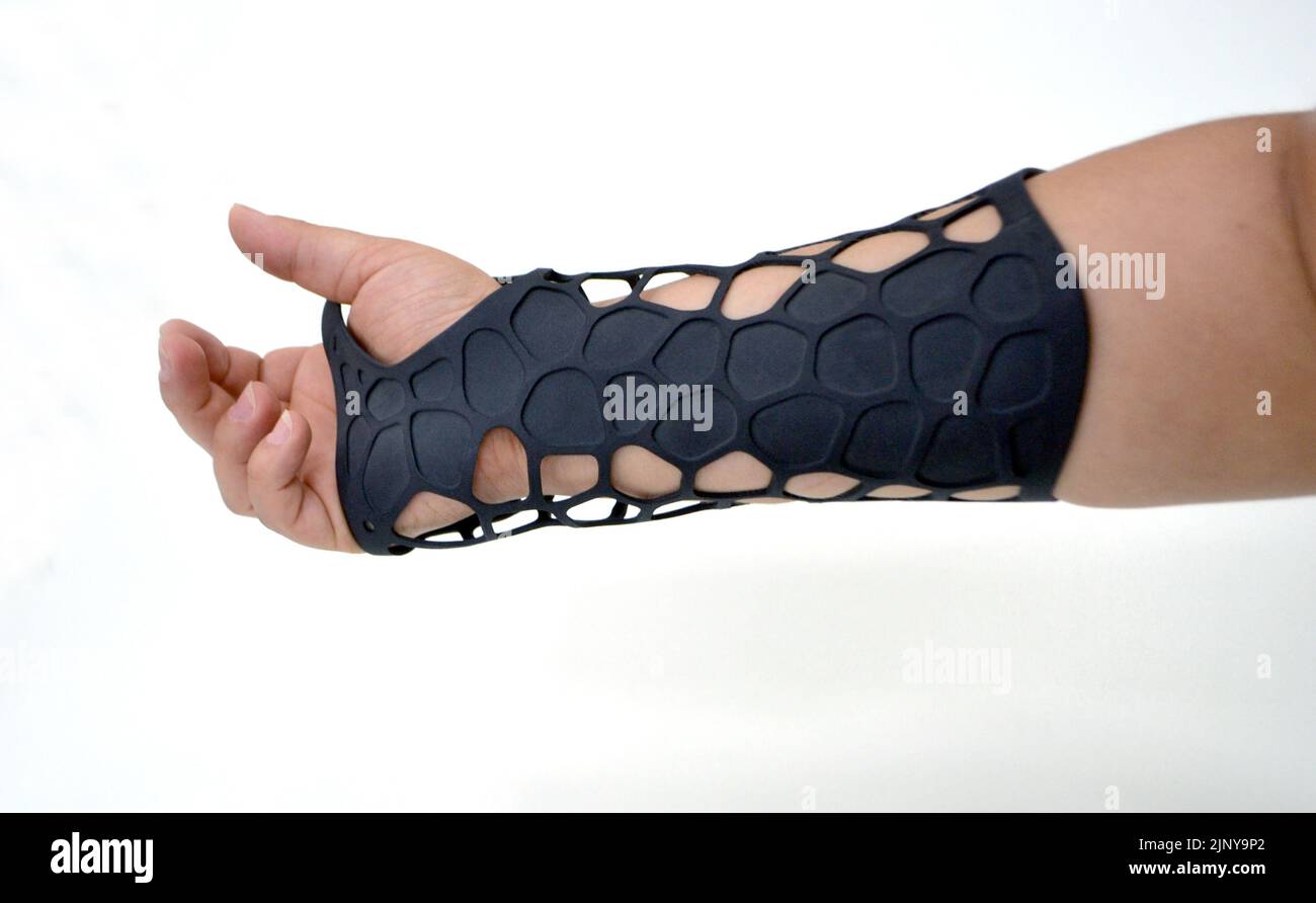 Orthopedic plastic prosthesis printed on powder 3D printer on hand ...