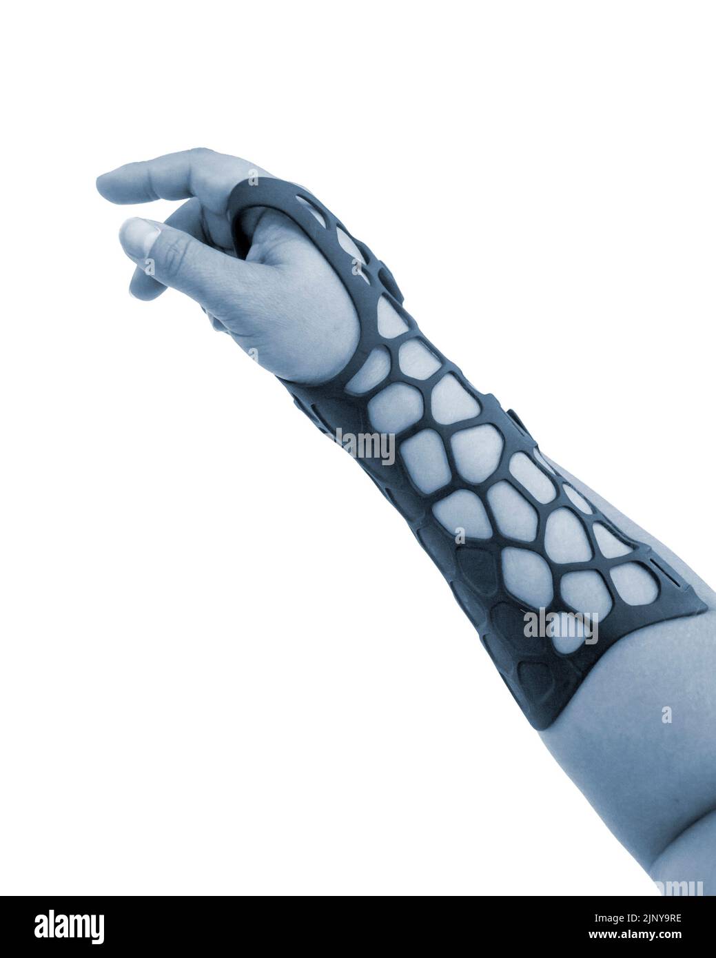 Orthopedic plastic prosthesis printed on powder 3D printer on hand ...