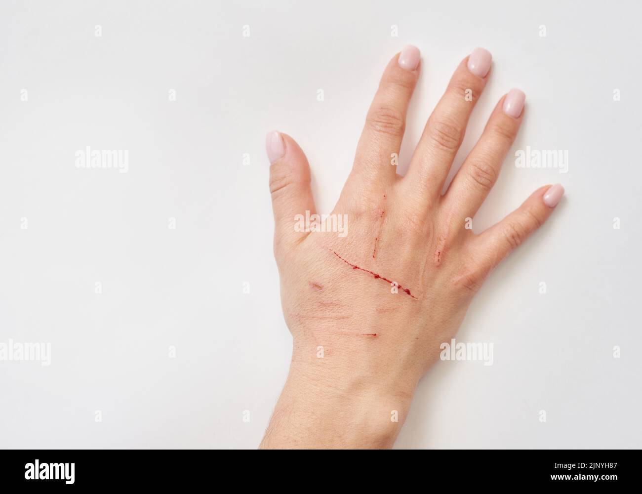 Cat scratches arm hi-res stock photography and images - Alamy