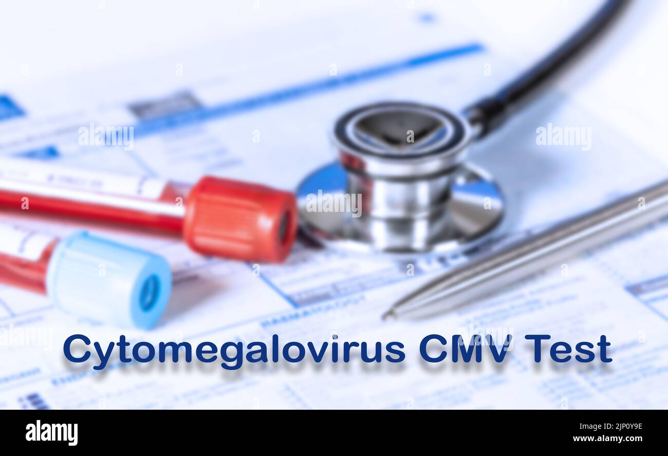 Cytomegalovirus CMV Test Testing Medical Concept. Checkup list medical ...
