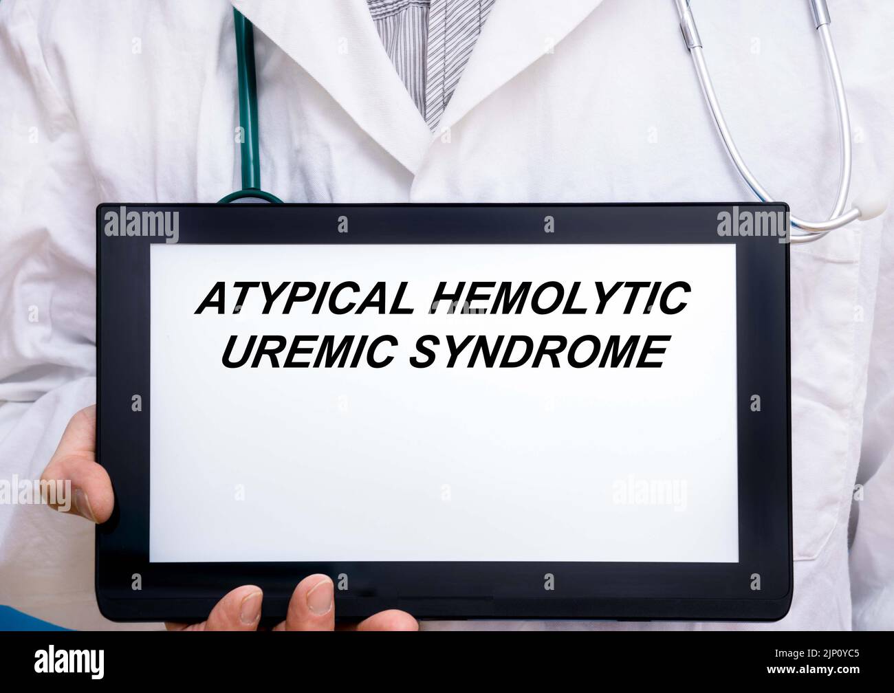 Atypical hemolytic uremic syndrome disease hi-res stock photography and ...
