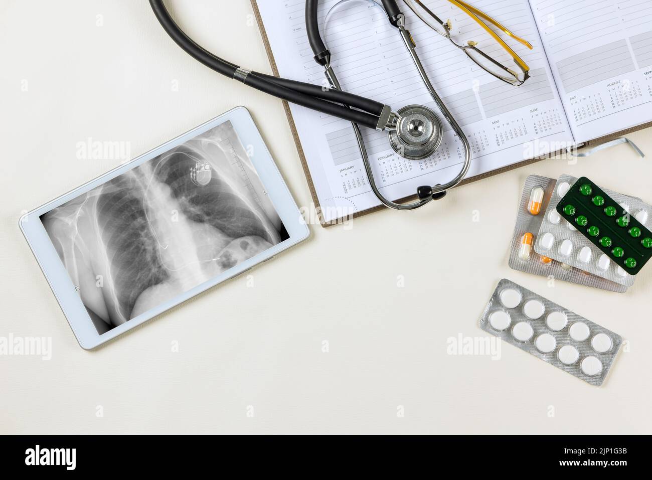 x-ray image, cardiology, cardiac pacemaker, radiology, x-rays, xray ...