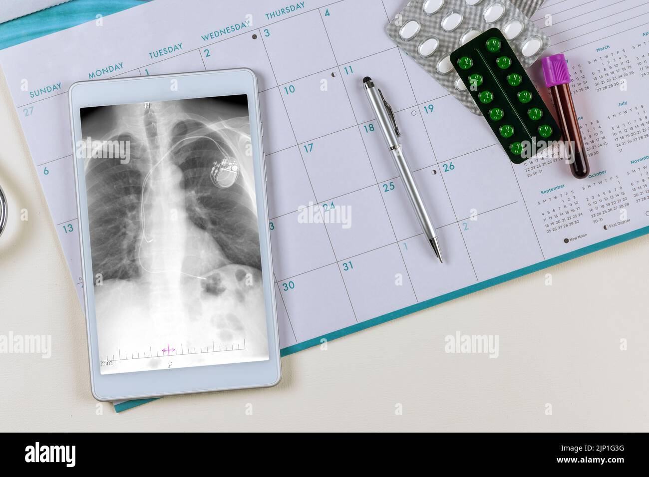 x-ray image, cardiology, cardiac pacemaker, radiology, x-rays, xray ...