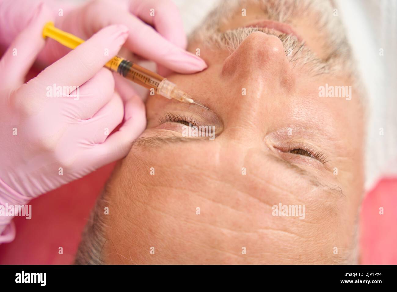 Injection syringe under skin hi-res stock photography and images - Alamy