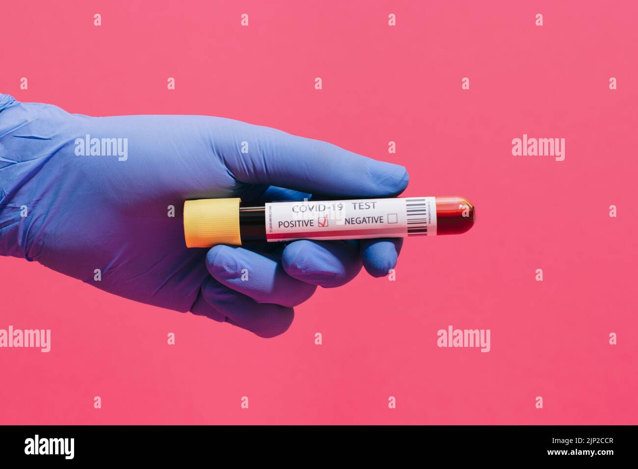 positive, blood test, covid-19, positives, blood tests Stock Photo - Alamy