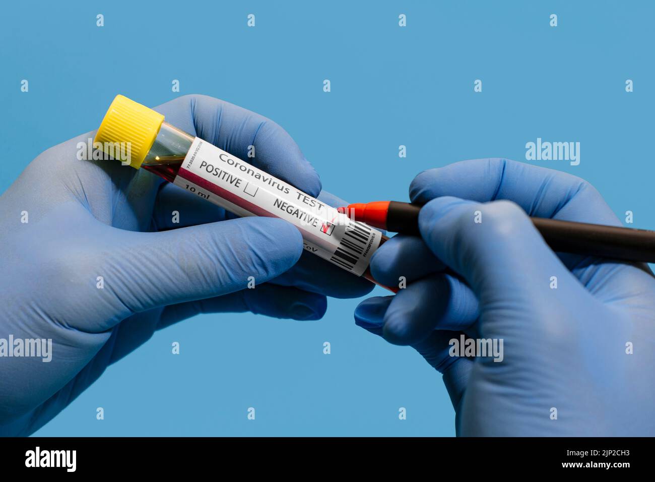 ticking, negative, blood sample, blood test, covid-19, negatives, blood ...