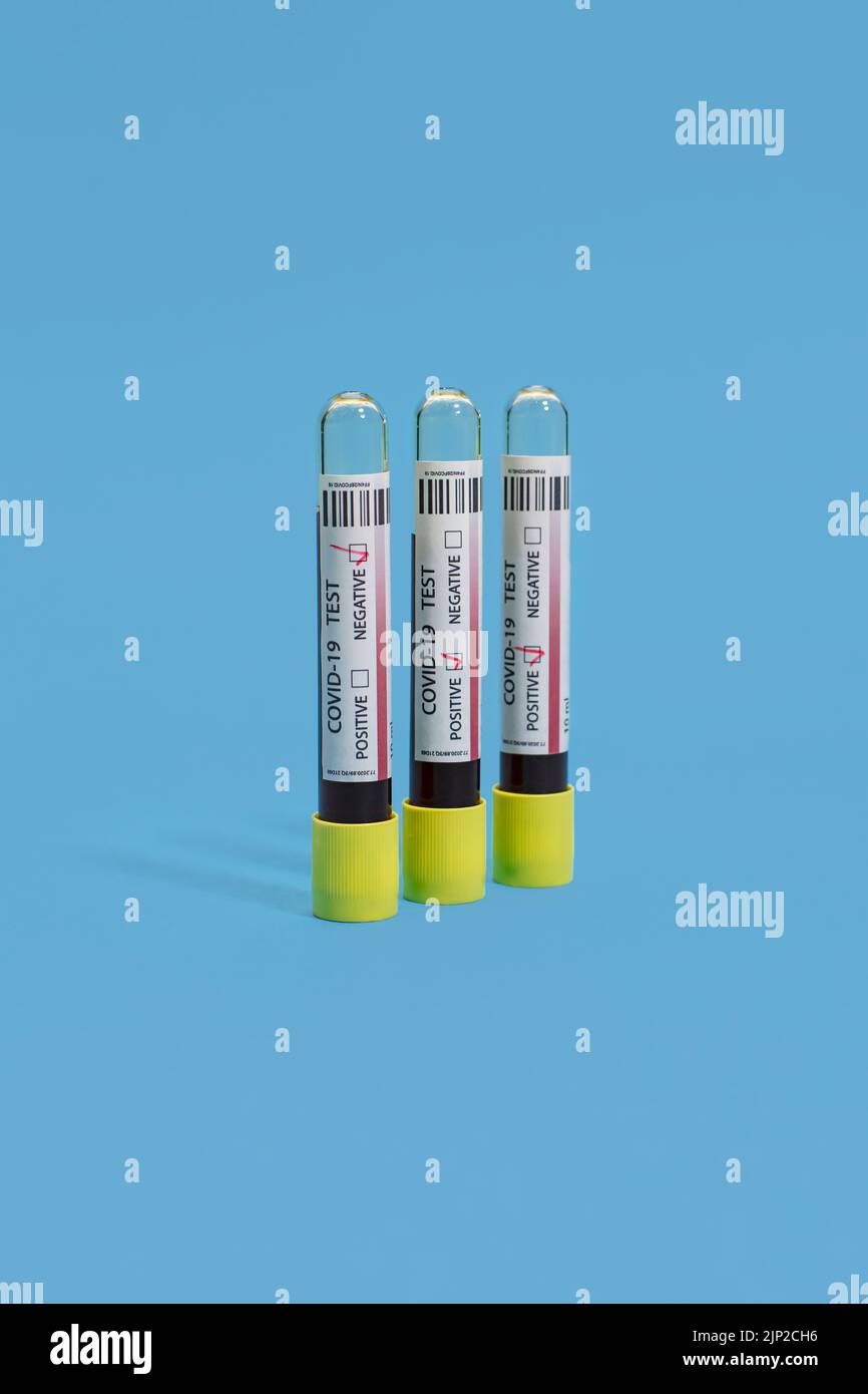 positive, test, negative, blood sample, covid-19, positives, tests ...