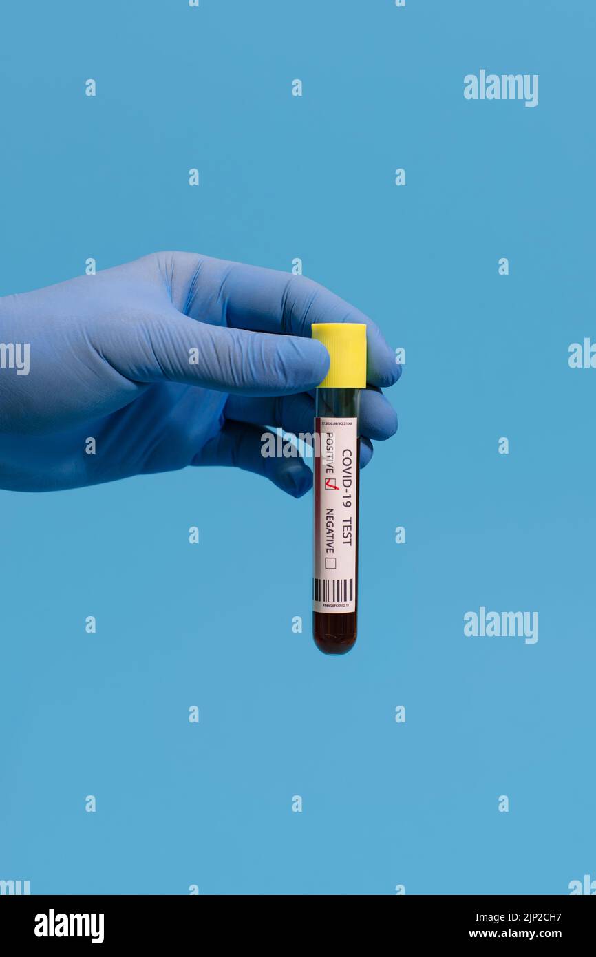 Corona positives hi-res stock photography and images - Alamy