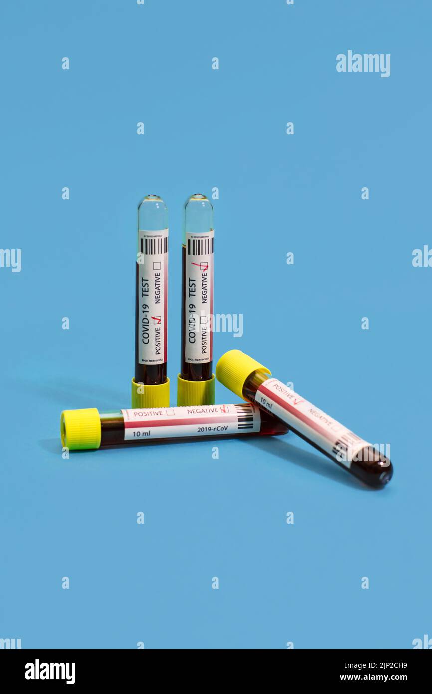 positive, negative, blood sample, covid-19, corona test, positives ...