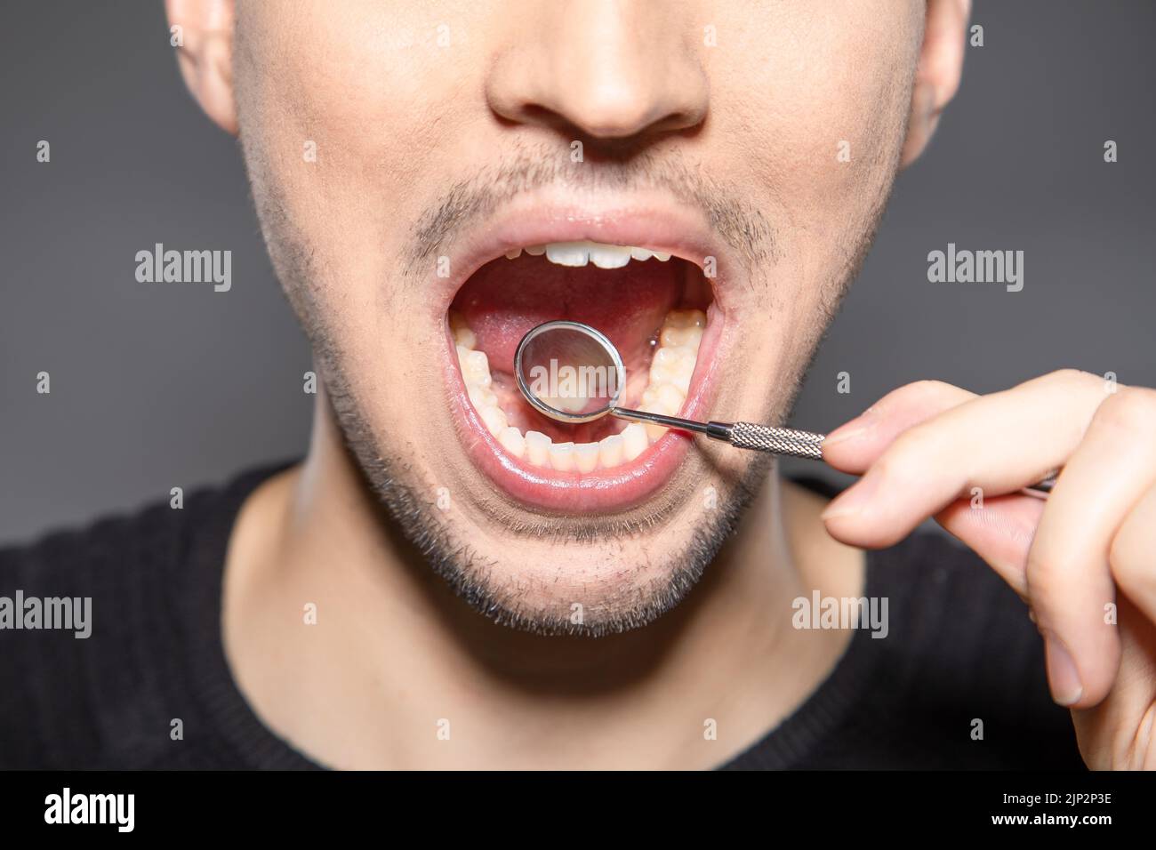 A closeup of person with mirror in mouth is checking the backside of ...