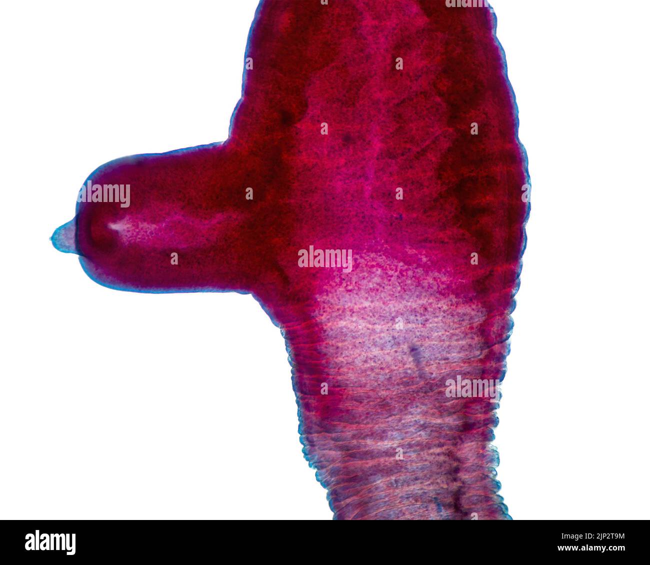 Hydra With Bud Chlorohydra Viridissima Showing Asexual Reproduction