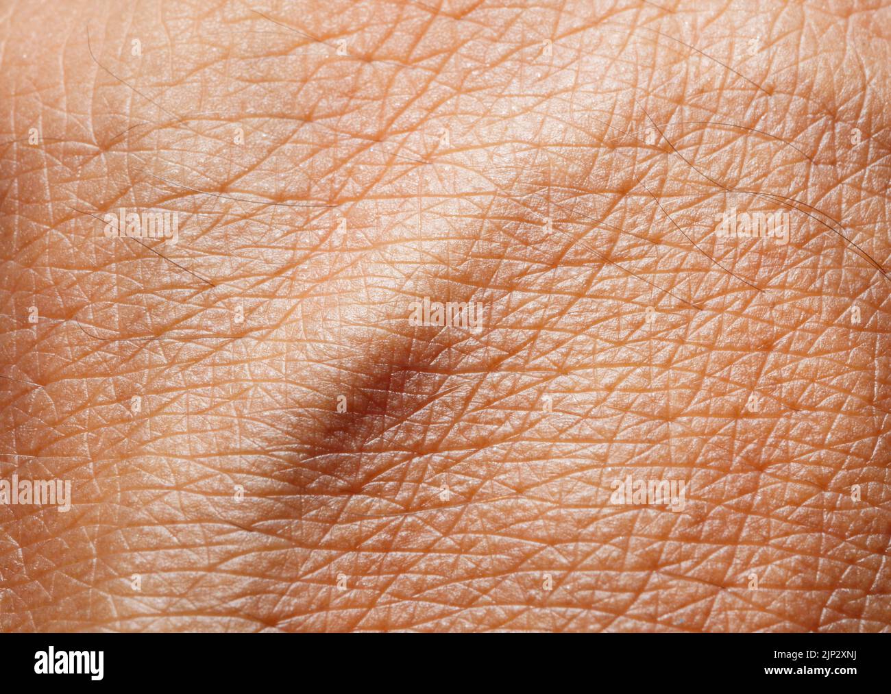 Close up of Human Skin Texture Stock Photo - Alamy