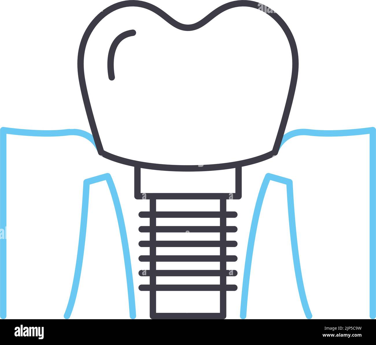 dental implants line icon, outline symbol, vector illustration, concept ...