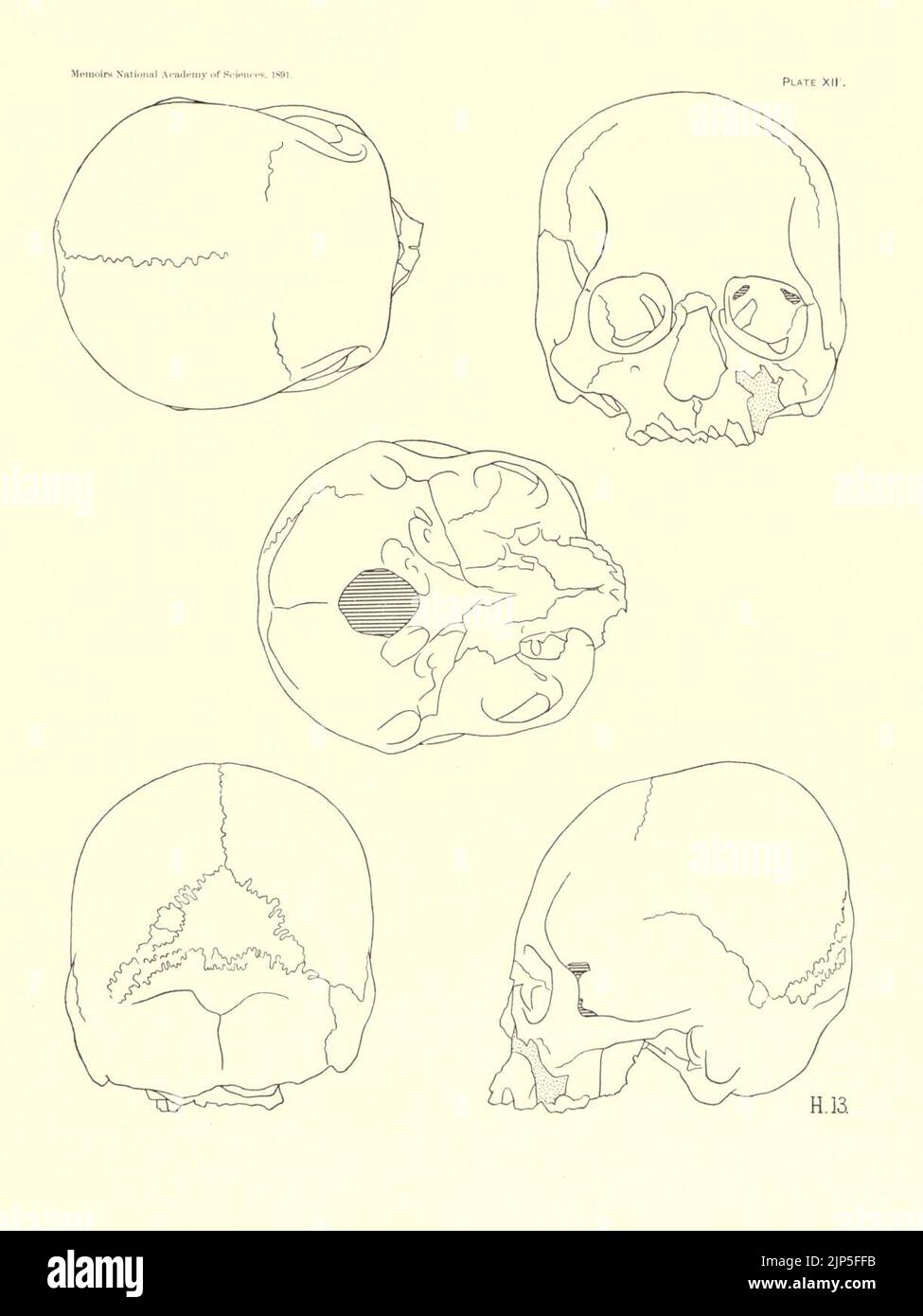 The human bones of the Hemenway collection in the United States Army ...