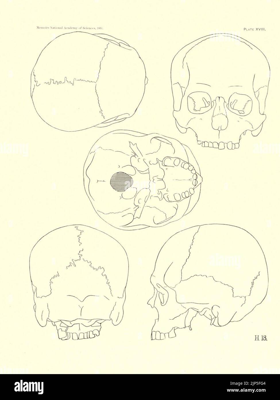 The human bones of the Hemenway collection in the United States Army ...