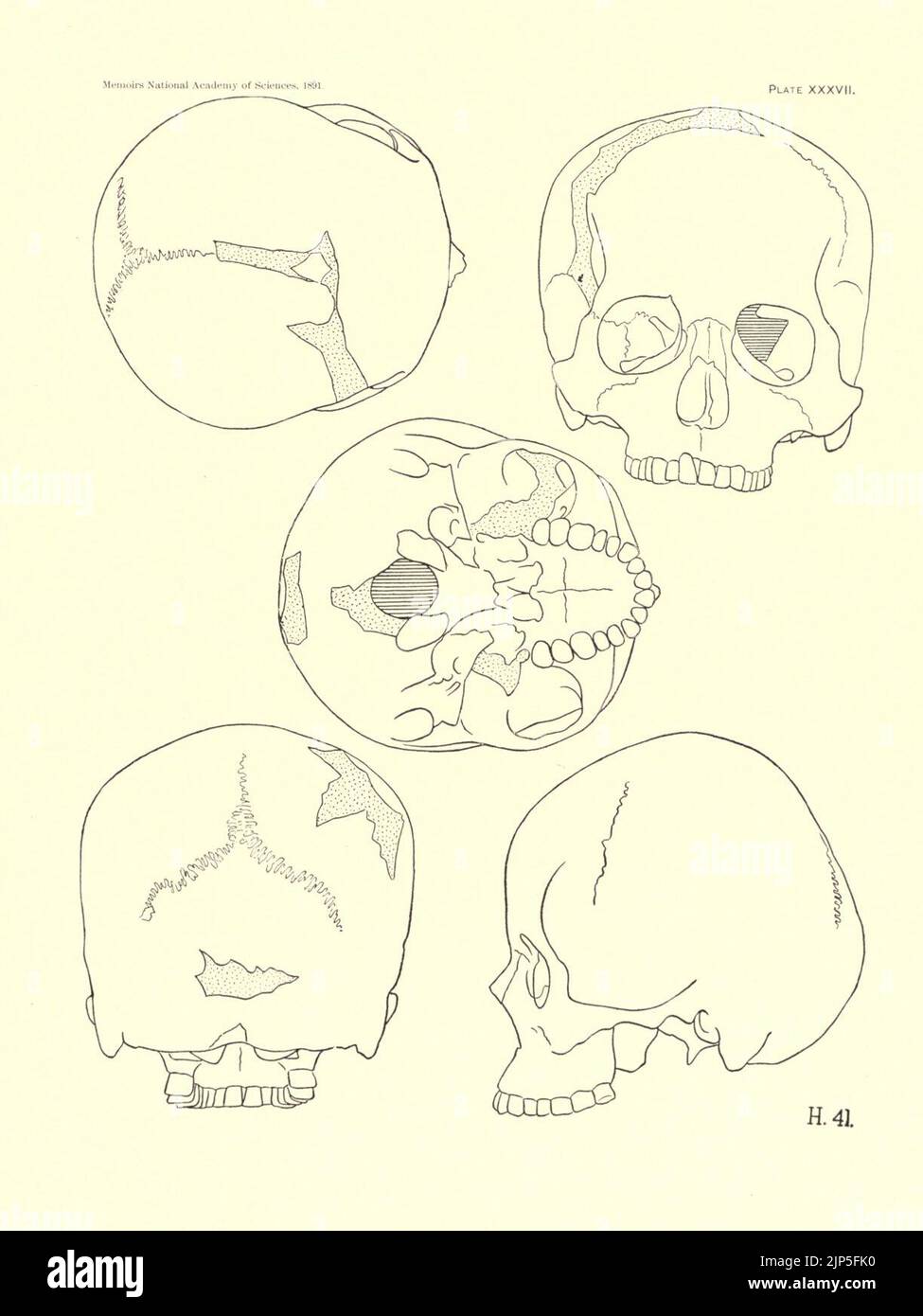 The human bones of the Hemenway collection in the United States Army ...