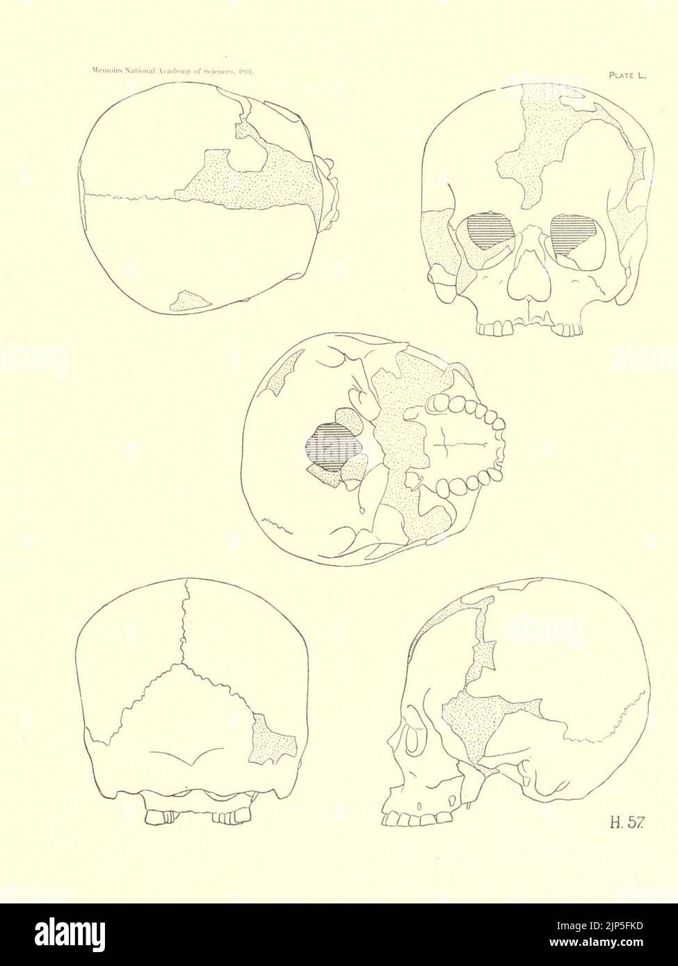 The human bones of the Hemenway collection in the United States Army ...