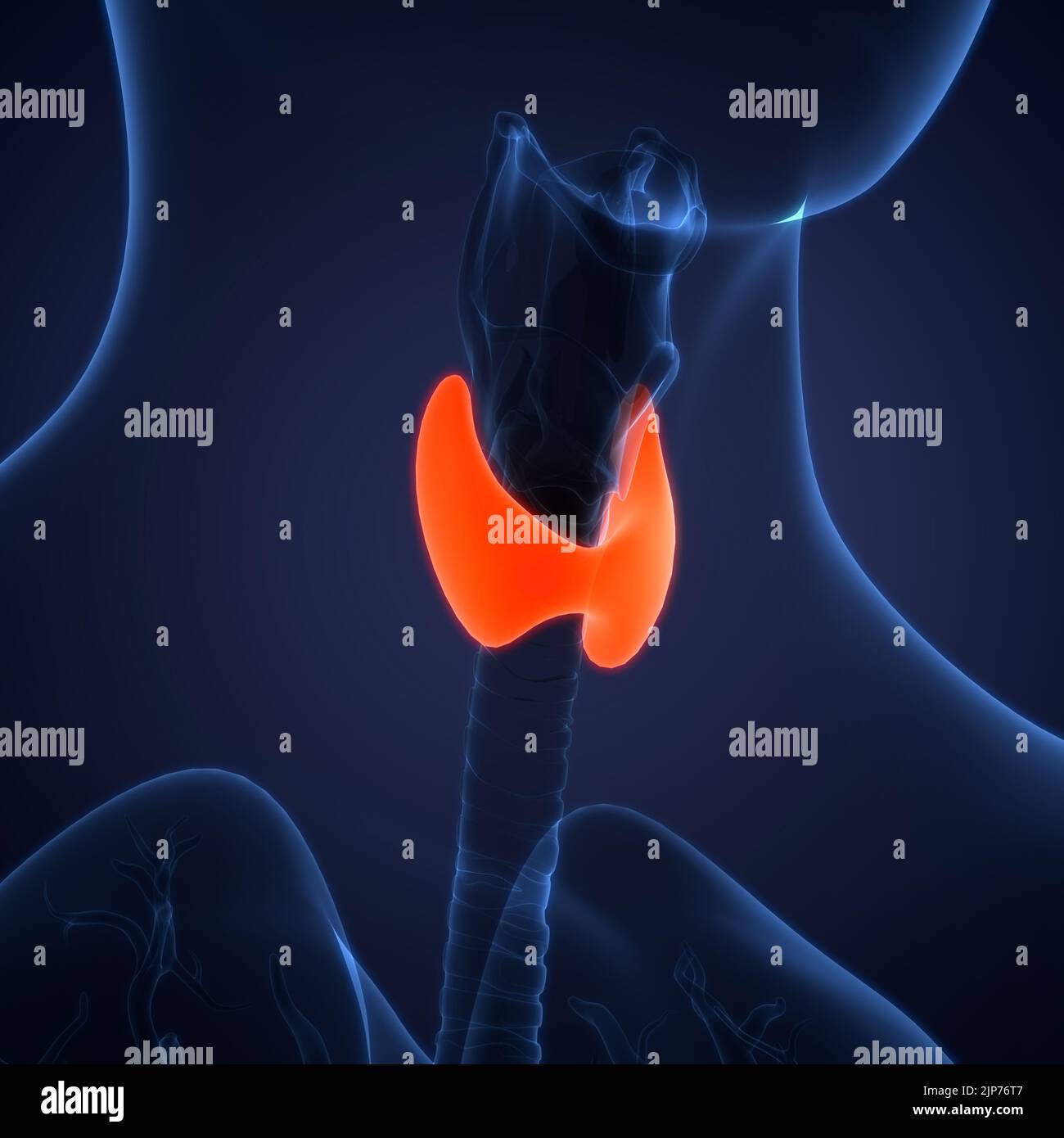 Hyperthyroidism hi-res stock photography and images - Alamy