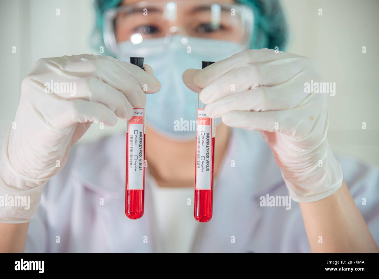 A doctor or scientist is holding an antigen blood testing tube for ...