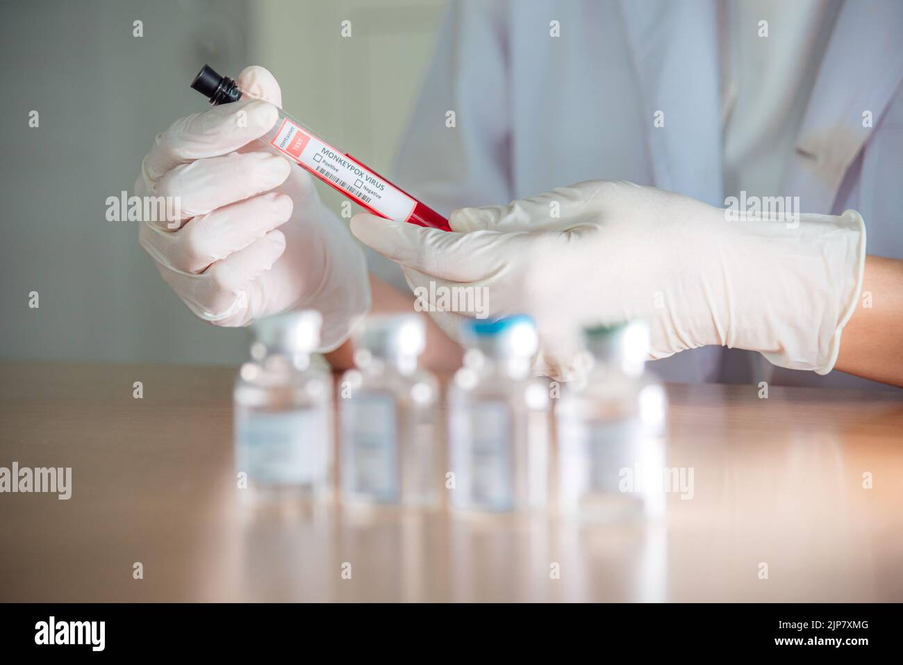 A doctor or scientist is holding an antigen blood testing tube for ...
