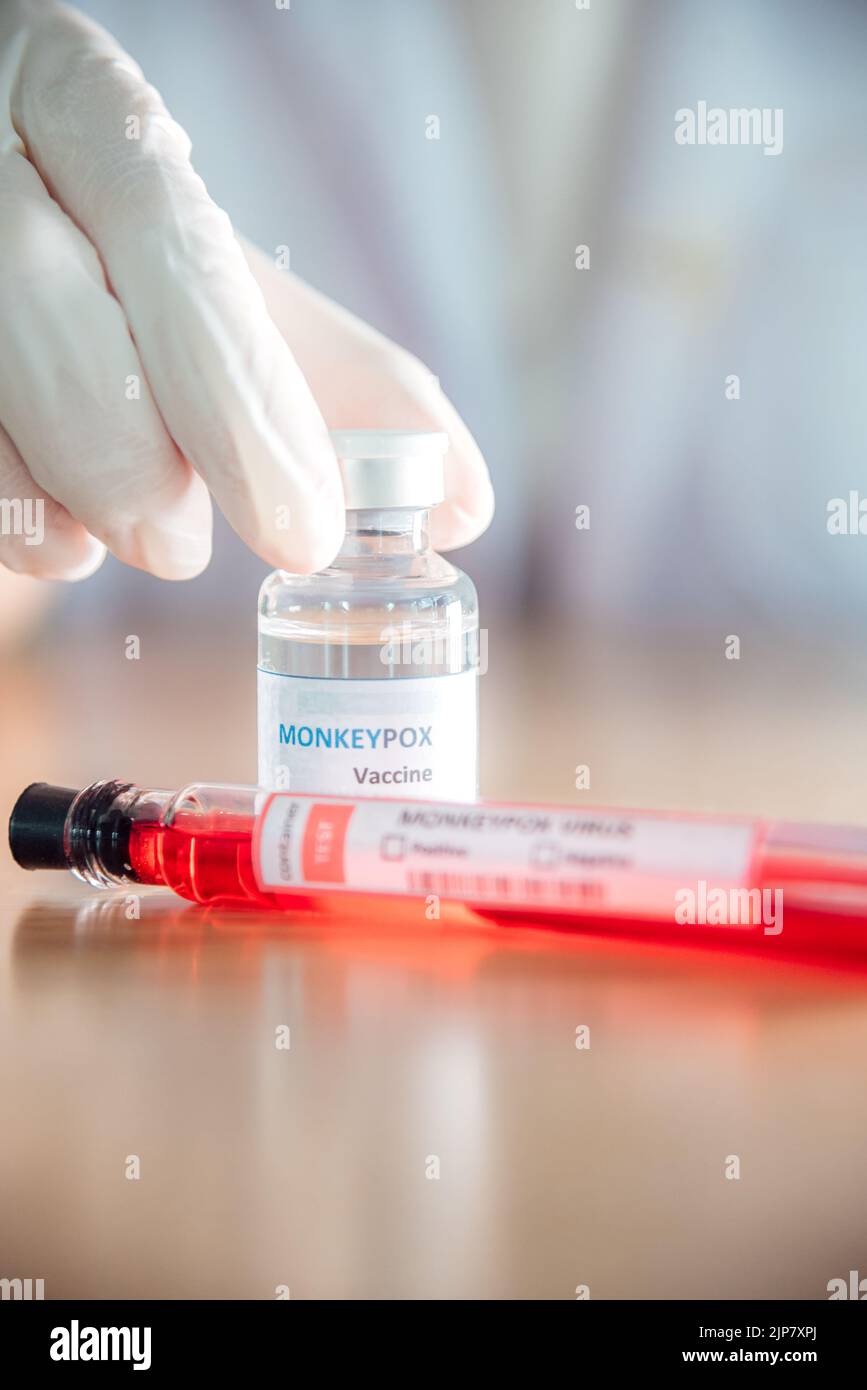 Blood sample monkeypox smallpox hi-res stock photography and images - Alamy