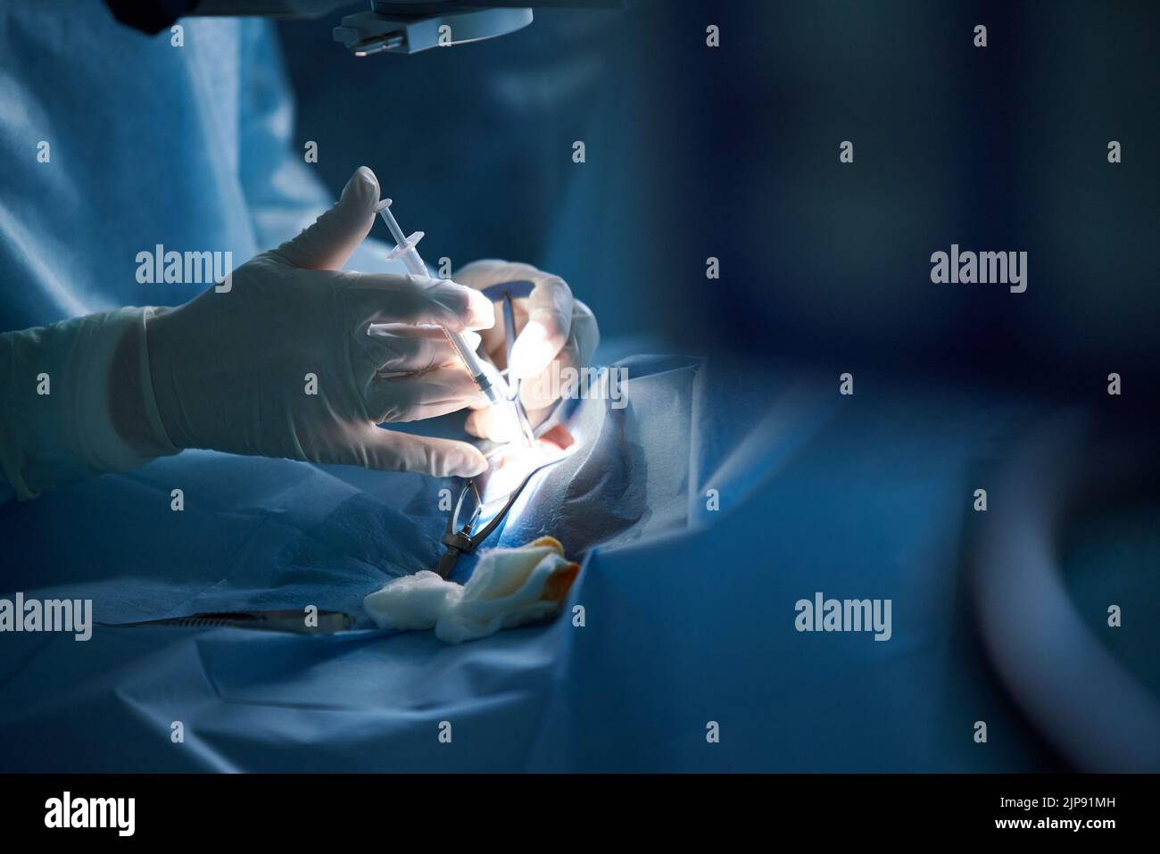 injection, operating, augenoperation, augenchirurgie, injections Stock ...