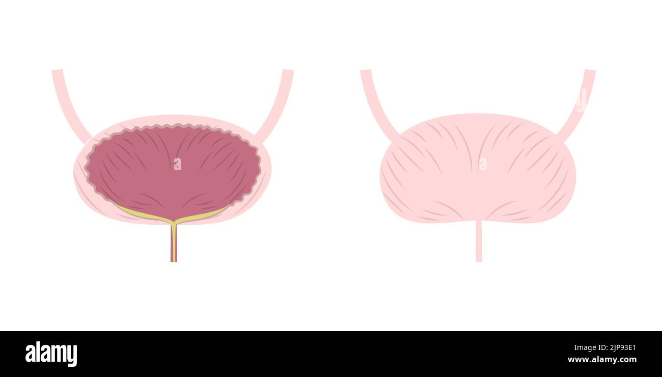 Internal and external view of urinary bladder. Medical chart of ...