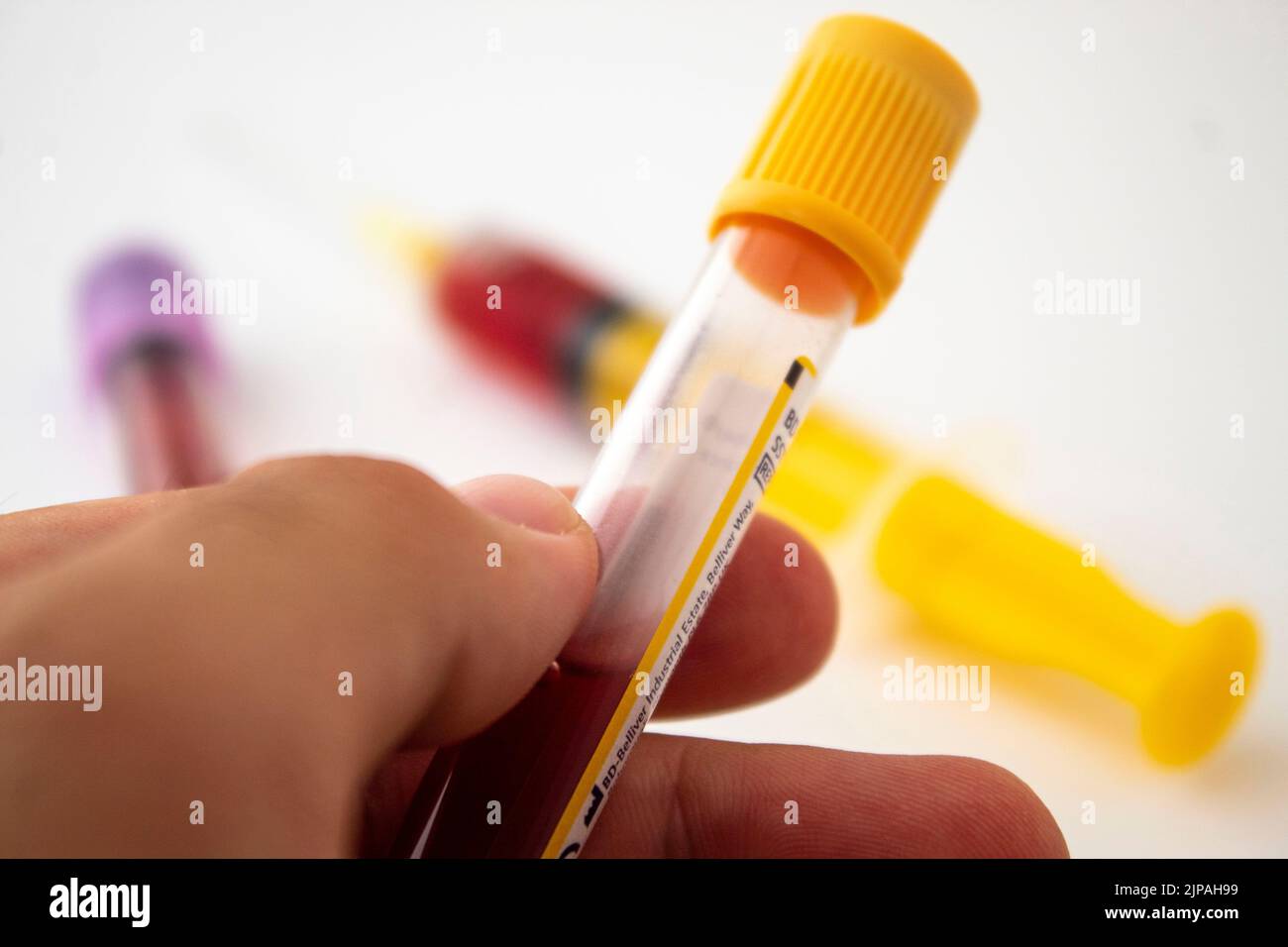 Blood Test In Yellow Tube at Walter Abbott blog