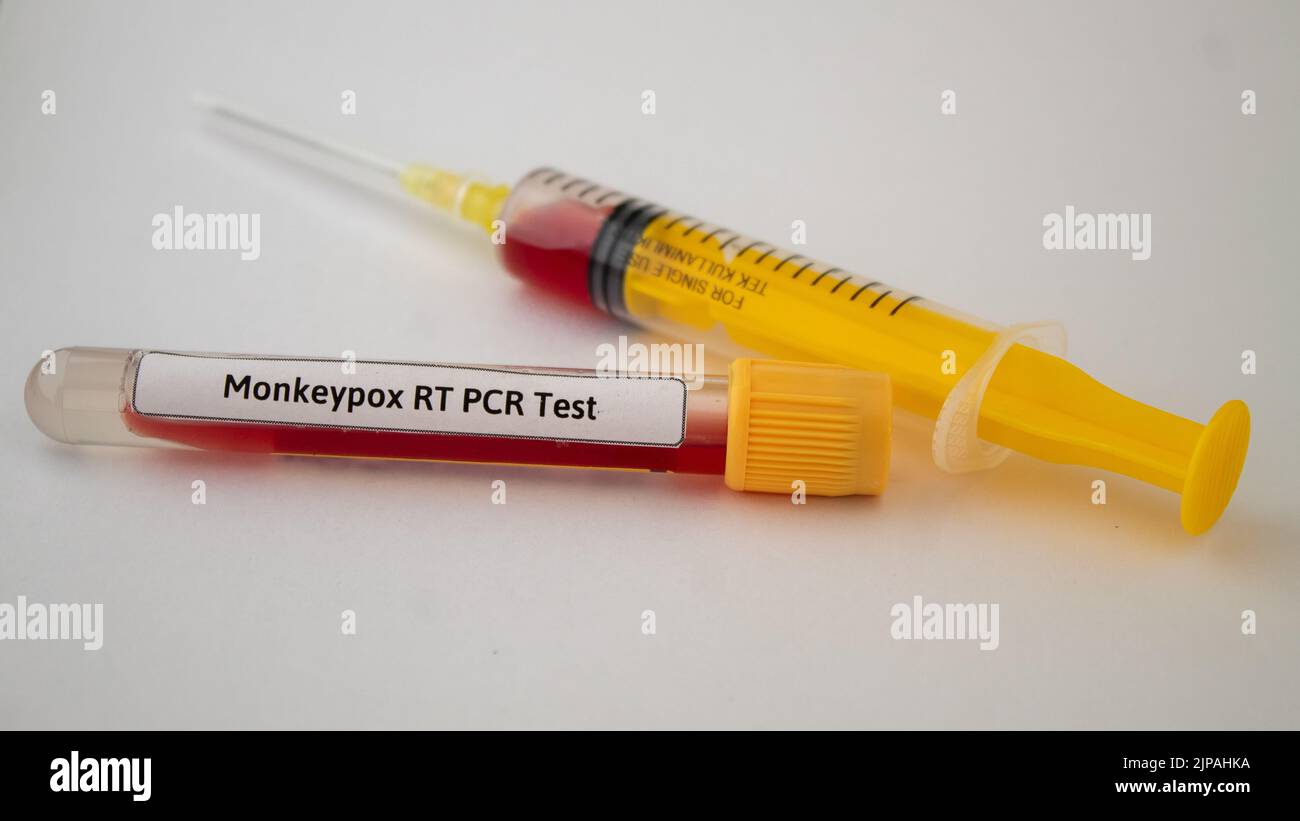 Blood Test In Yellow Tube at Walter Abbott blog