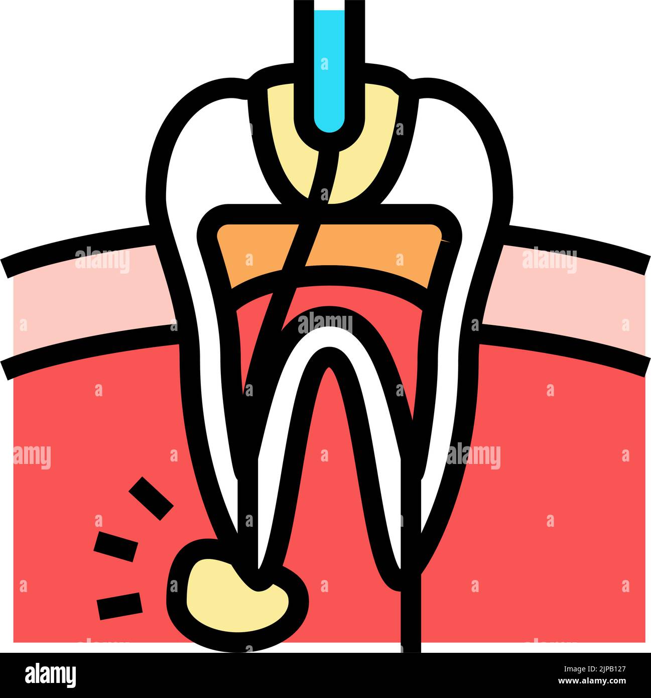 root canal treatment color icon vector illustration Stock Vector Image ...