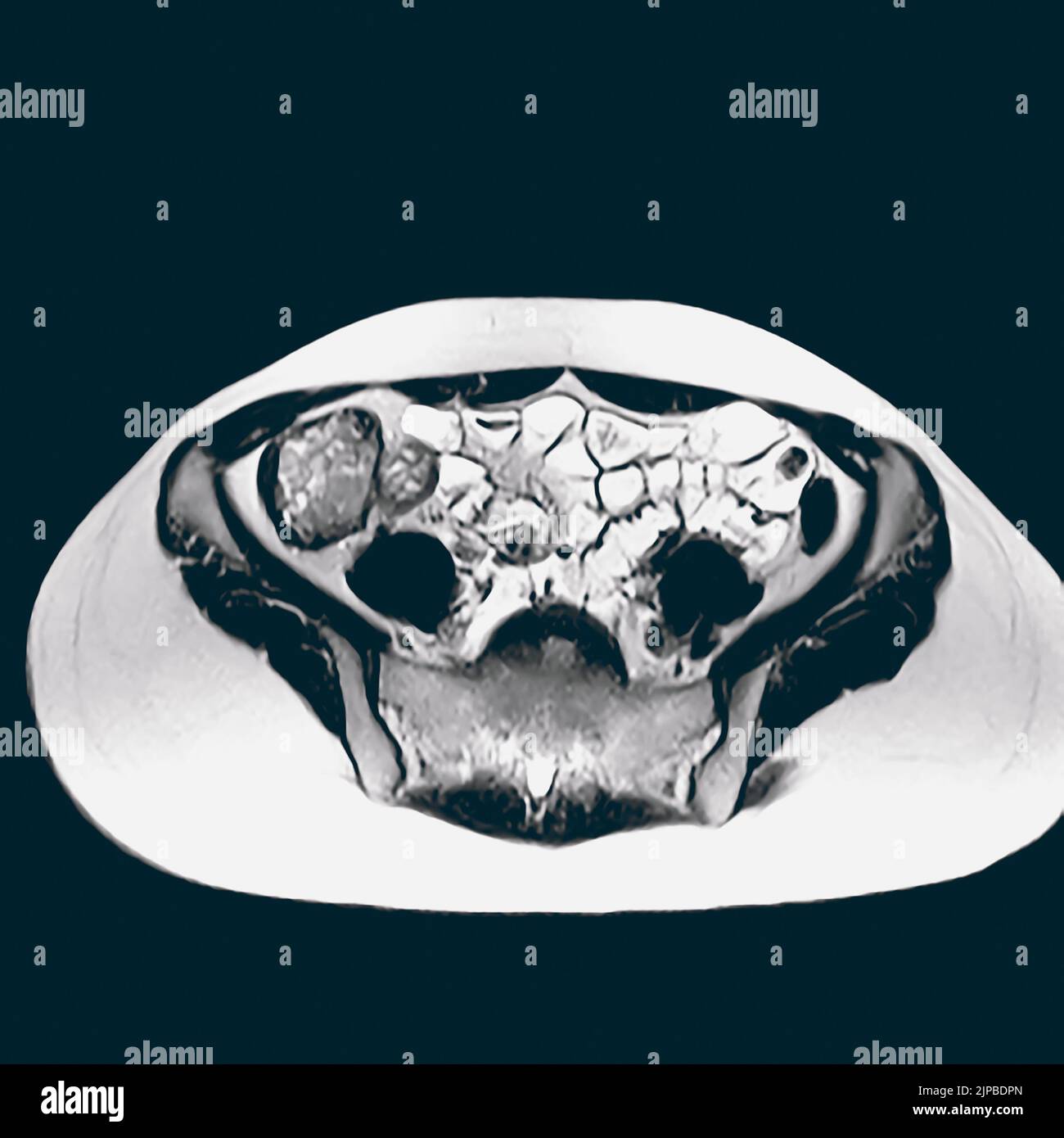 Enterography CT scan Stock Photo - Alamy
