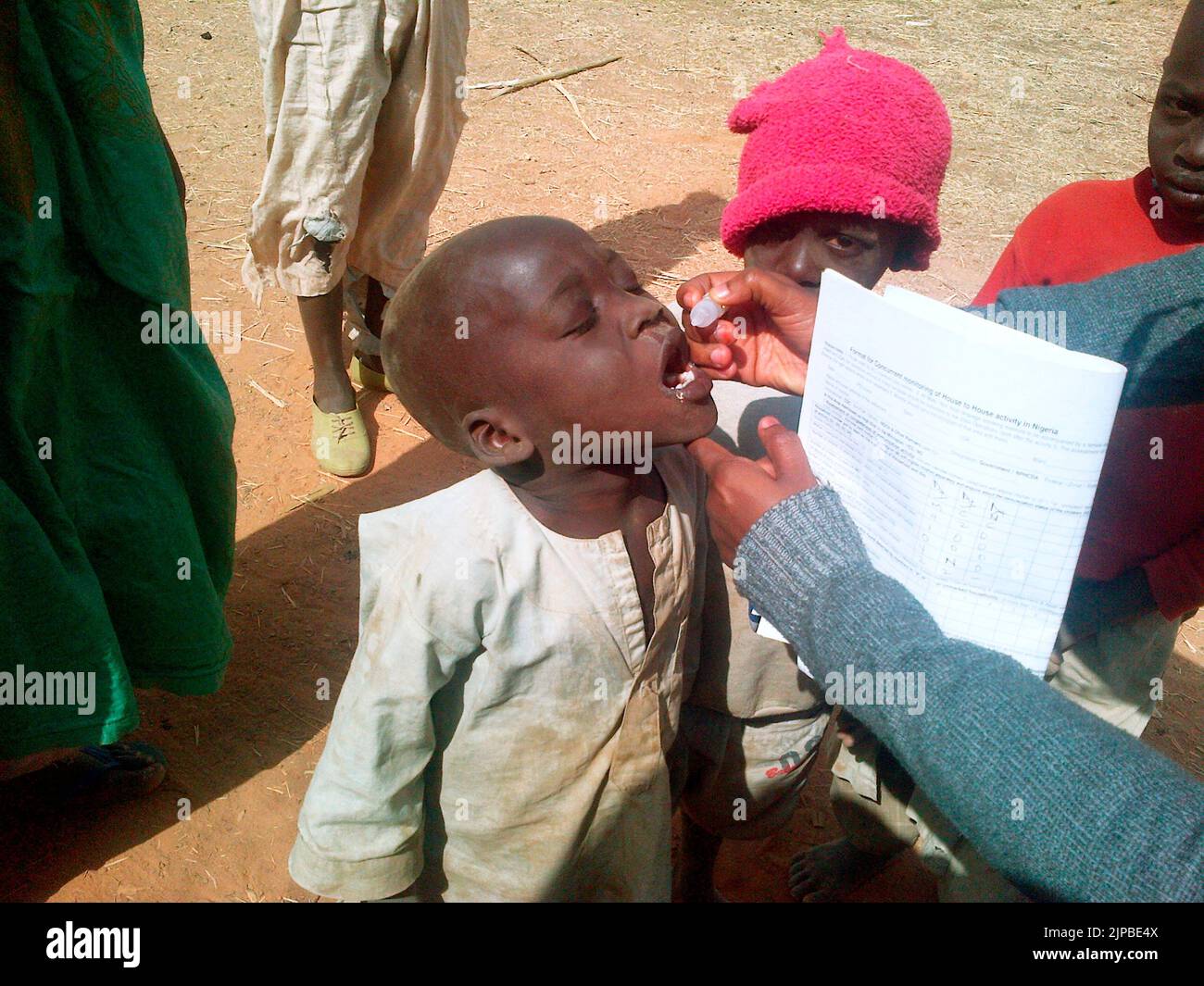 Child receiving oral polio vaccine Stock Photo - Alamy