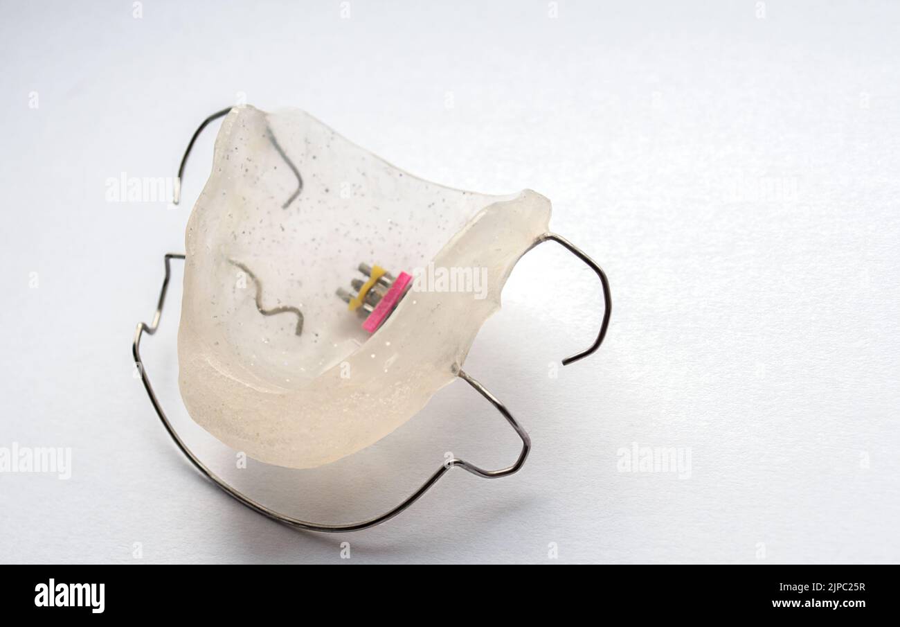 orthodontic retainer, complicated, for the correction of molar, copy ...