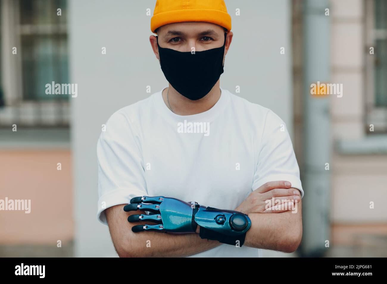 Young disabled man with artificial prosthetic hand wearing medical ...