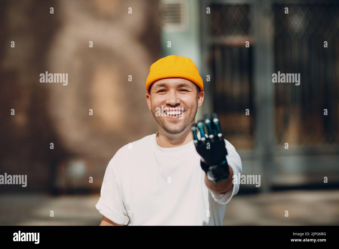 Young disabled man reach with artificial prosthetic hand in casual ...