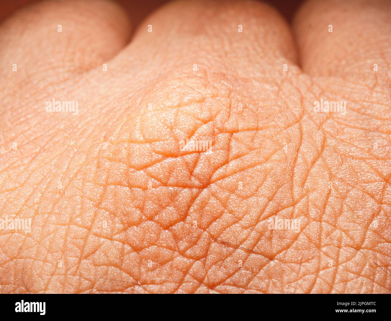 Close up of Human Skin Textur Stock Photo - Alamy